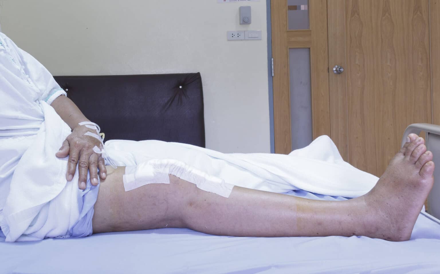 Does Medicare Cover Knee Replacement Surgery Medicare Plan Tips